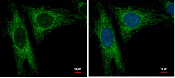 Anti-LRPPRC/GP130 antibody (ab228994) | Abcam