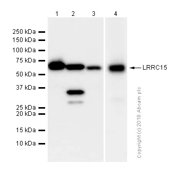 Anti-LRRC15 antibody [EPR8188(2)], recombinant (ab150376) | Abcam