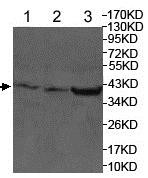 Anti-LSM11 antibody (ab201159) | Abcam