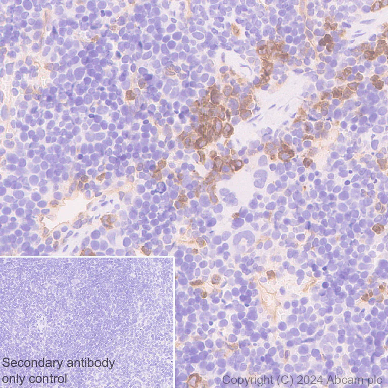 LY6C抗体[RM1151] (ab317272)| Abcam中文官网