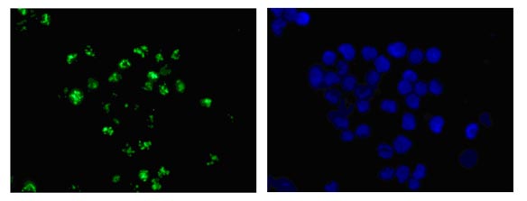 Anti-LYAR antibody [EPR14352-9] (ab182138) | Abcam