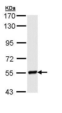 Anti-Lyn antibody (ab137338) | Abcam
