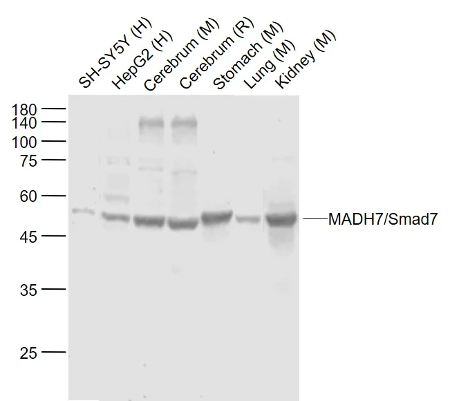 Anti-MADH7/SMAD7 antibody (ab216428) | Abcam