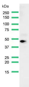 Anti-MAGEA1 antibody [SP188] (ab227664) | Abcam