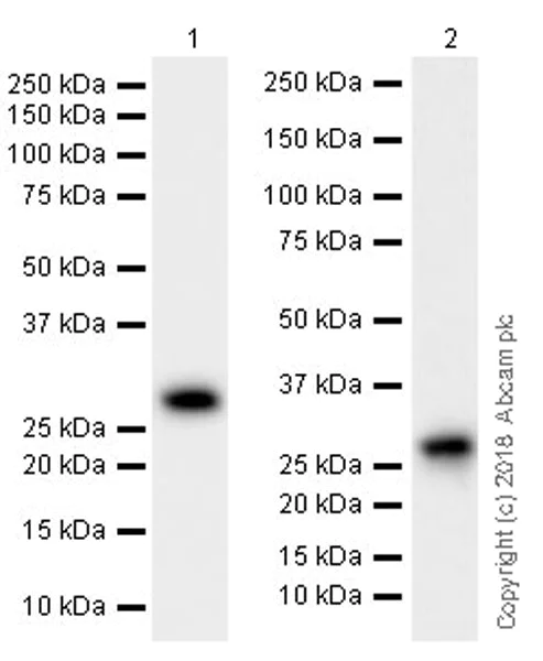 Anti-Mannan Binding Lectin/MBL 抗体 [EPR18381-83] (ab212060) | Abcam