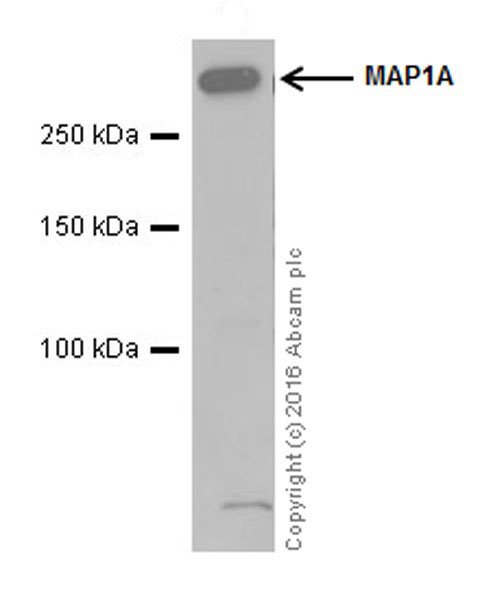 Anti-MAP1A antibody [EPR18994] (ab184350) | Abcam