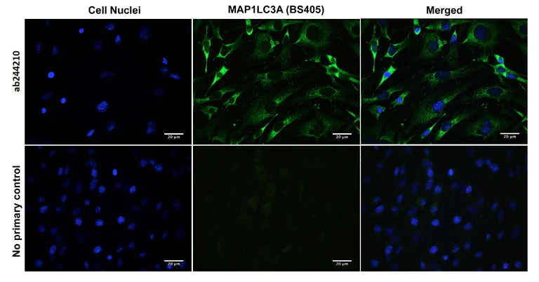 Anti-MAP1LC3A antibody [BS405] - Autophagosome Marker (ab244210) | Abcam