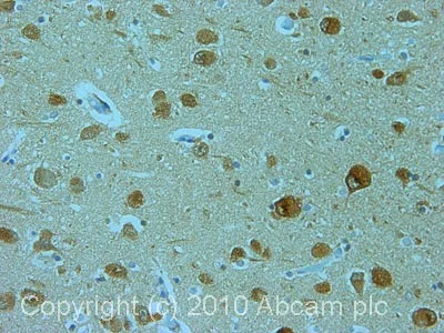 MAP1LC3A抗体[EP1528Y] - Autophagosome Marker (ab52628)| Abcam中文官网