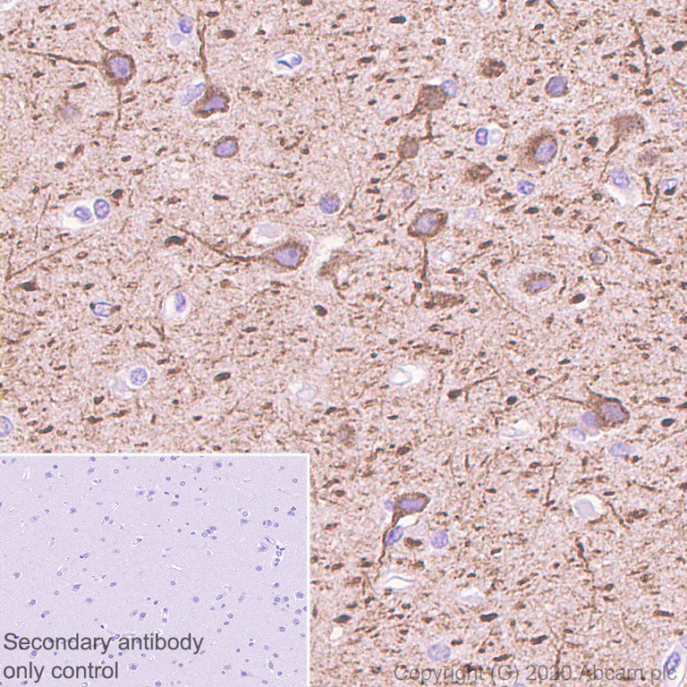 Anti-MAP2 antibody [AA6] - Neuronal Marker (ab254144) | Abcam