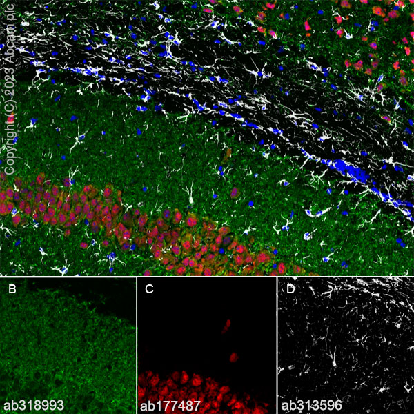 Anti-MAP2 antibody [EPR19691] - Chicken IgY (Chimeric) - BSA and Azide ...