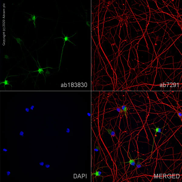 Anti-Anti-MAP2 antibody [EPR19691], recombinant (ab183830) | Abcam