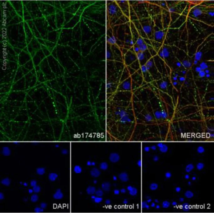 Anti-Anti-MAP2 antibody [EPR19691], recombinant (ab183830) | Abcam