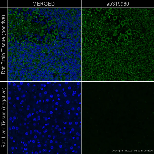 MAP2抗体[EPR19691] - Neuronal Marker - 鸡 IgY (Chimeric) (ab319979)| Abcam中文官网