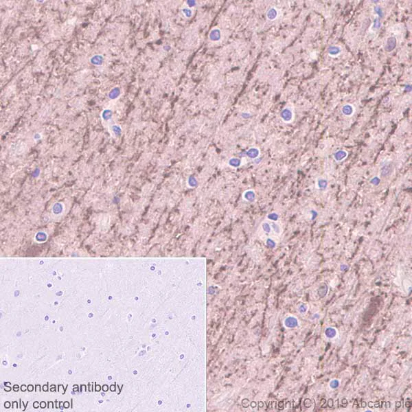 Anti-MAP2 antibody [EPR22641-16] - Neuronal Marker (ab254264) | Abcam