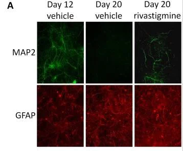 Anti-MAP2 antibody [HM-2] - Neuronal Marker (ab11267) | Abcam