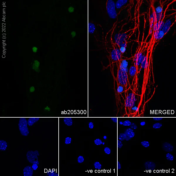 MAP2抗体[HM-2] - Neuronal Marker (ab11267)| Abcam中文官网