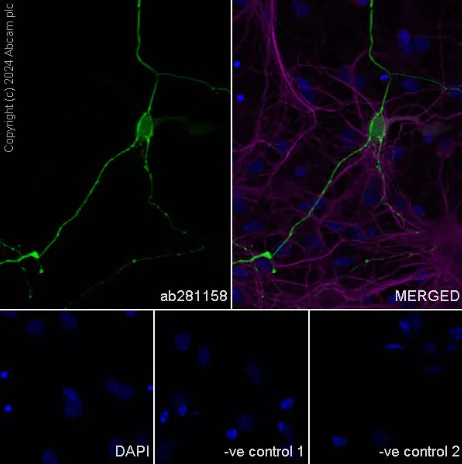Anti-MAP2 antibody [HM-2] - Neuronal Marker (ab11267) | Abcam