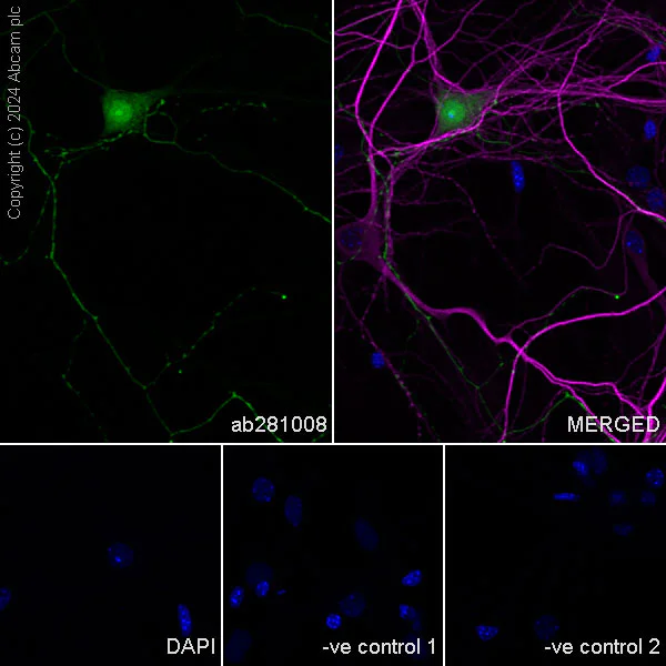 Anti-MAP2 antibody [HM-2] - Neuronal Marker (ab11267) | Abcam
