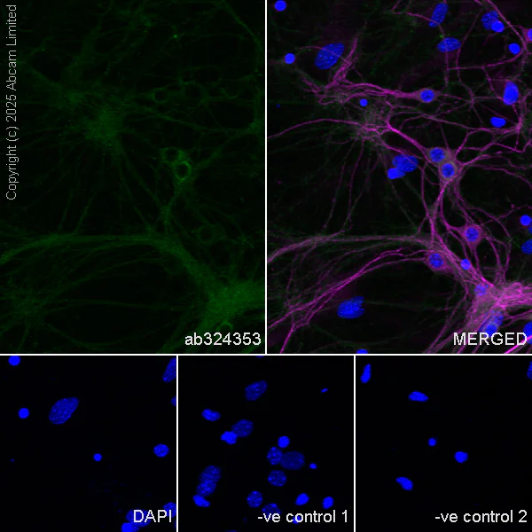 Anti-MAP2 antibody [HM-2] - Neuronal Marker (ab11267) | Abcam