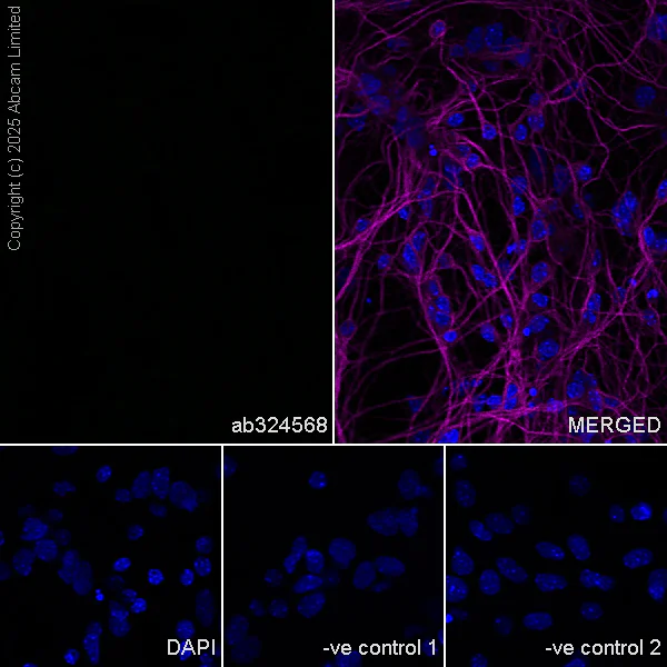 MAP2抗体[HM-2] - Neuronal Marker (ab11267)| Abcam中文官网