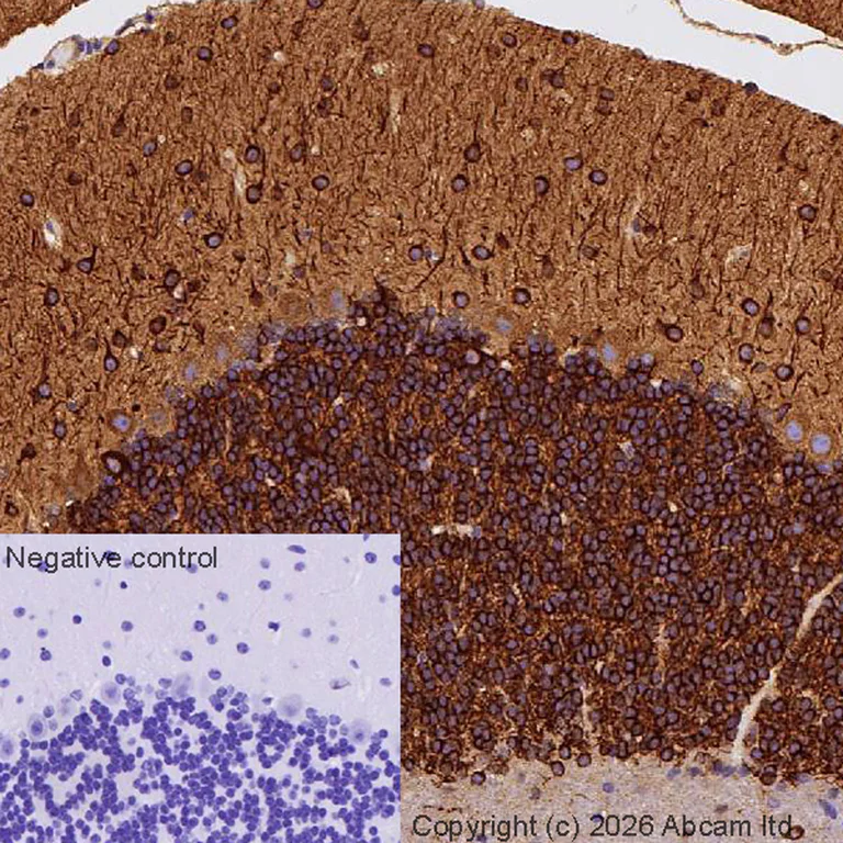 Anti-MAP2 antibody - neuronal marker (ab32454) | Abcam
