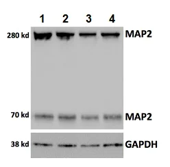 Anti-MAP2 antibody - neuronal marker (ab32454) | Abcam