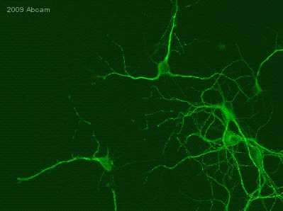 MAP2抗体- Neuronal Marker (ab5392)| Abcam中文官网