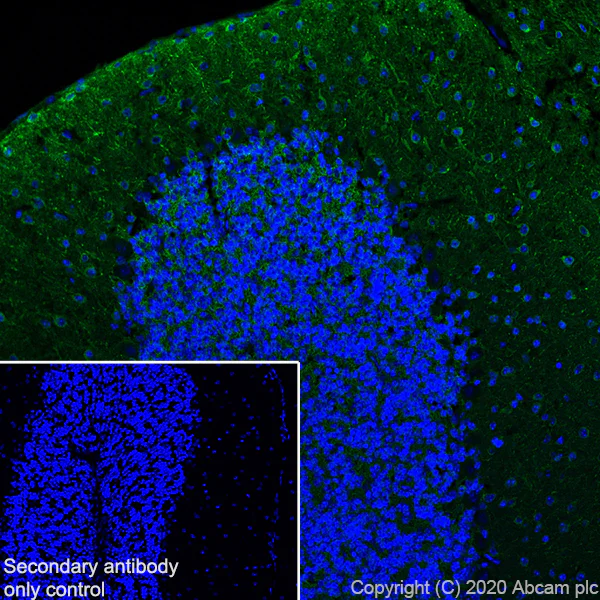 MAP2抗体[RM1010] - Neuronal Marker (ab281588)| Abcam中文官网