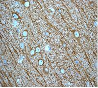 Anti-MAP2 antibody - chicken polyclonal (ab5392) | Abcam