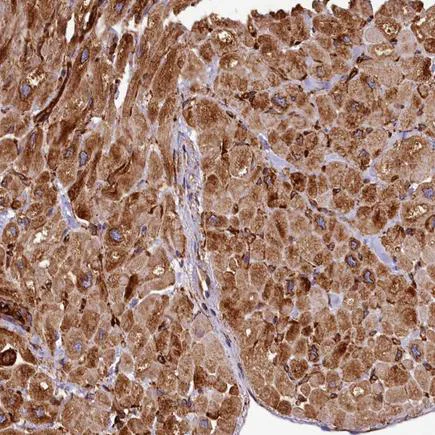 Anti-MAP4 antibody (ab224543) | Abcam