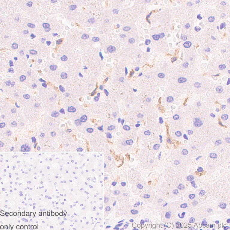 Anti-MARCO antibody [RM1219] (ab323717) | Abcam中文官网