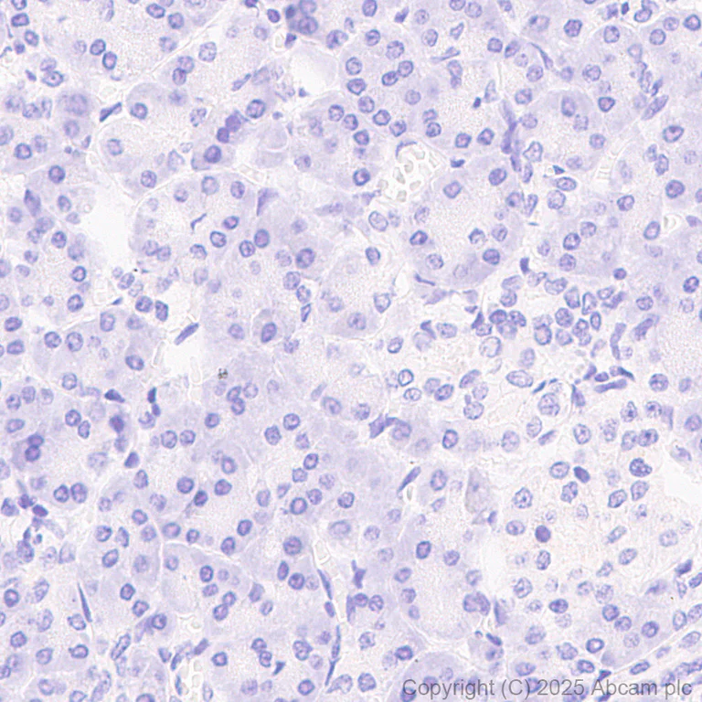 Anti-MARCO antibody [RM1219] (ab323717) | Abcam