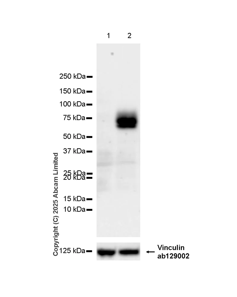 Anti-MARCO antibody [RM1219] (ab323717) | Abcam