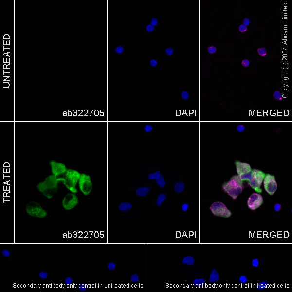 Anti-MARCO antibody [RM2074] (ab322705) | Abcam中文官网