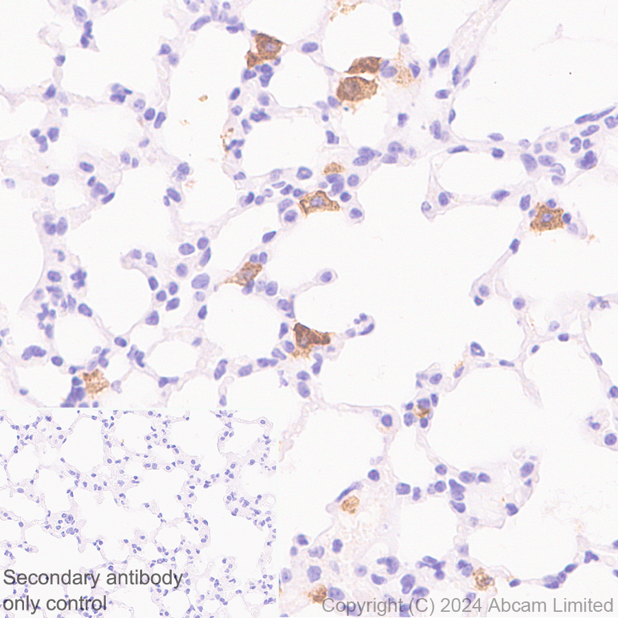 Anti-MARCO antibody [RM2074] (ab322705) | Abcam