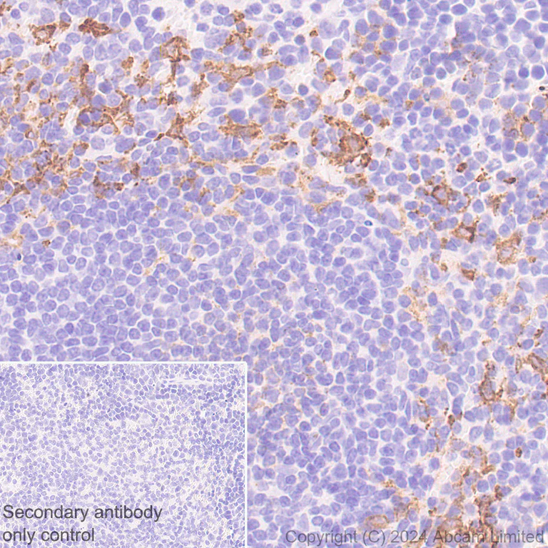 Anti-MARCO antibody [RM2074] (ab322705) | Abcam