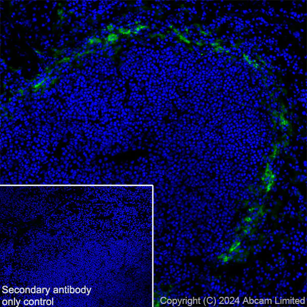 Anti-MARCO antibody [RM2074] (ab322705) | Abcam