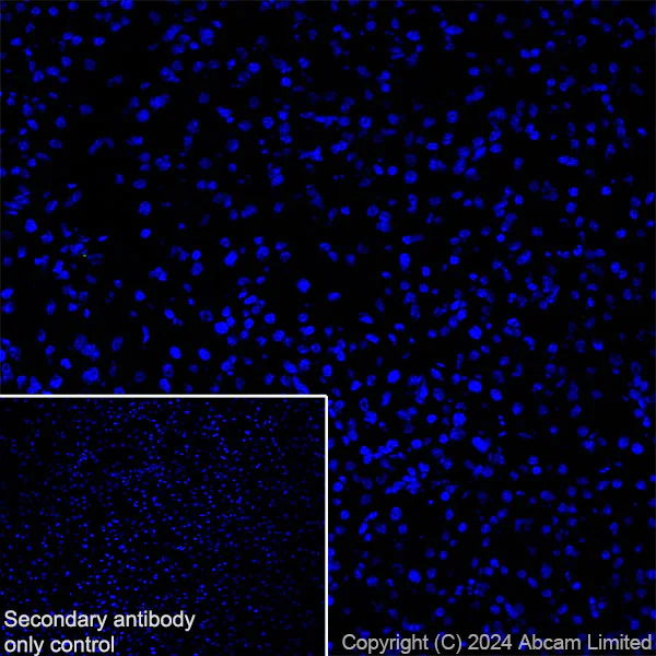 Anti-MARCO antibody [RM2074] (ab322705) | Abcam