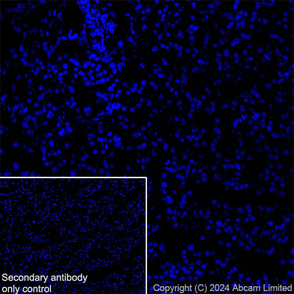 Anti-MARCO antibody [RM2074] (ab322705) | Abcam