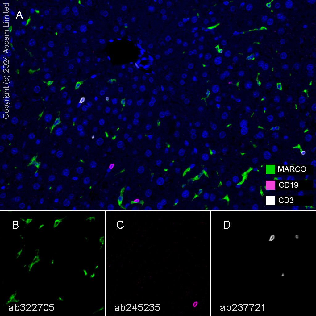 Anti-MARCO antibody [RM2074] (ab322705) | Abcam