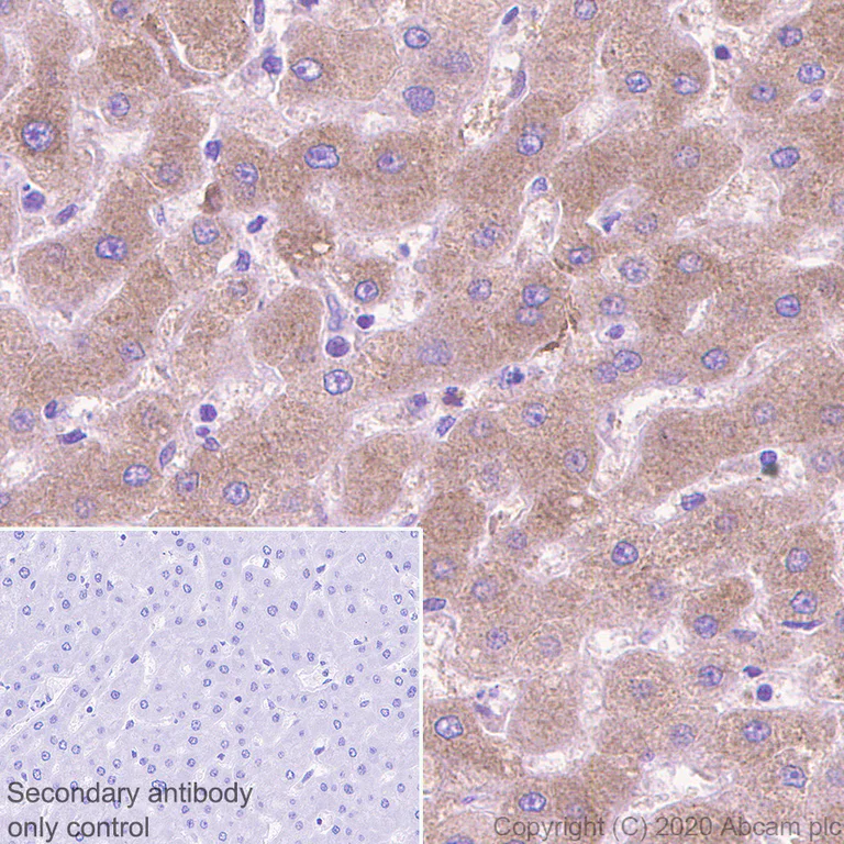 Anti-MASP2 antibody [EPR23588-44] (ab277520) | Abcam