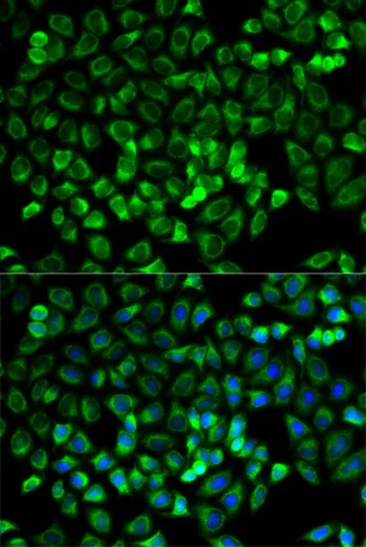 Anti-Mast Cell Tryptase antibody (ab196772) | Abcam