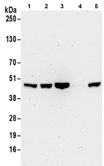 Anti-MAT2A antibody - N-terminal (ab186129) | Abcam