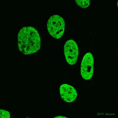 Anti-Matrin 3 antibody (ab84422) | Abcam