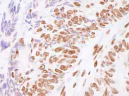 Anti-Matrin 3 antibody (ab84422) | Abcam