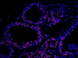 Anti-Matrin 3 antibody (ab84422) | Abcam