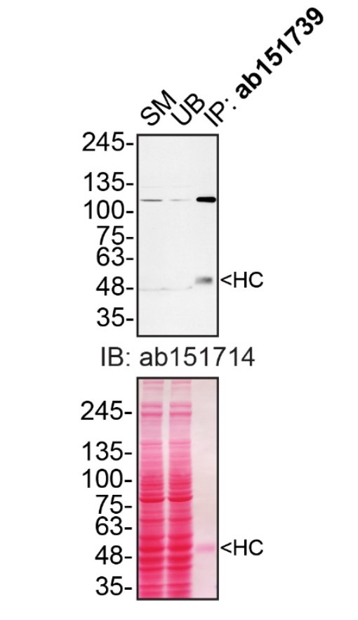 Anti-Matrin 3 antibody [EPR10634(B)] (ab151739) | Abcam