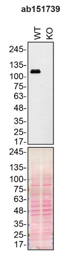 Anti-Matrin 3 antibody [EPR10634(B)] (ab151739) | Abcam