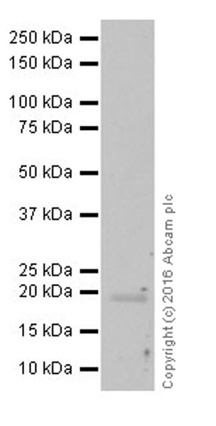 Anti-MAX antibody [EPR19352] - ChIP Grade (ab199489) | Abcam