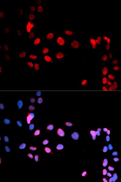 Anti-MAX (phospho S11) antibody (ab210819) | Abcam